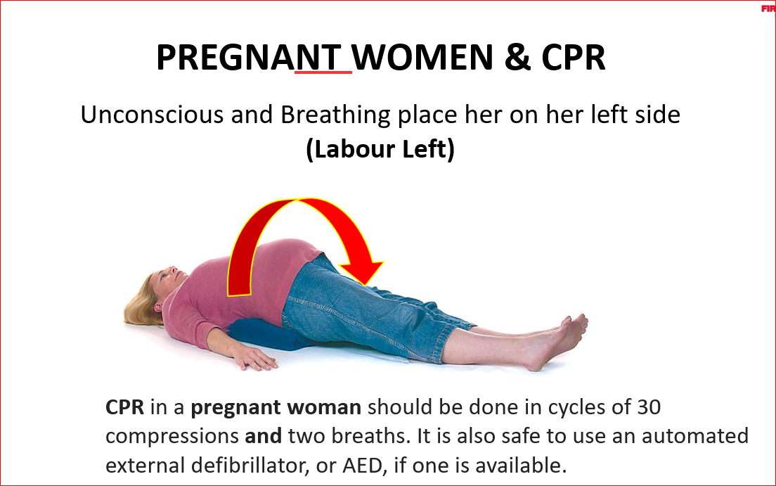 CPR for Pregnancy Resource - First Aid Pro Adelaide
