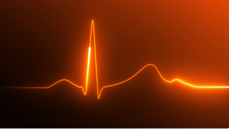 Five Common Causes of Sudden Death - First Aid Pro Adelaide